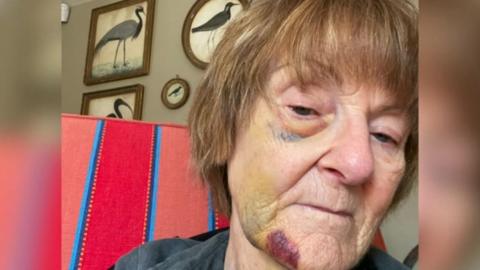 Woman, 80, injured by e-scooter on Canterbury pavement - BBC News