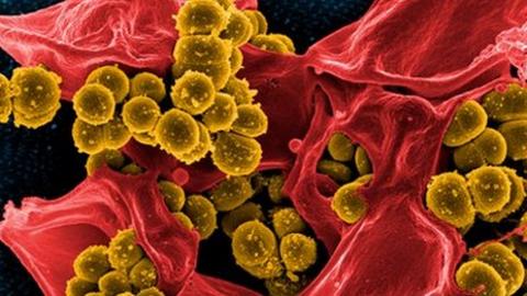 Modelling the spread of hospital bugs - BBC News