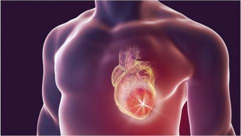 Switch to vaping 'helps smokers' hearts' - BBC News