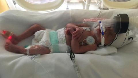 'World's smallest' surviving premature baby released from US hospital ...