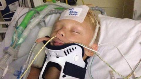 Car crash boy back at school after 'amazing' recovery - BBC News