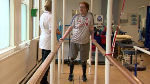 Spinal cord stimulation: 'Start of a new life' for amputee now able to ...