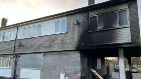 Peterlee: Appeal raises £10,000 for boy hurt in suspected arson