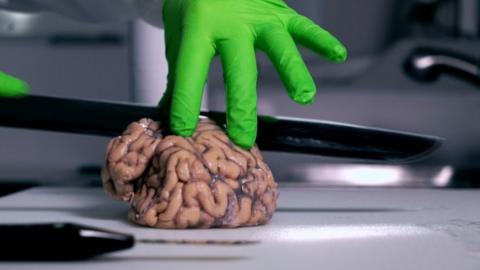 Banking Britain's brains: The story of a scientific resource - BBC News