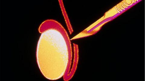 Male contraceptive gel passes monkey test - BBC News
