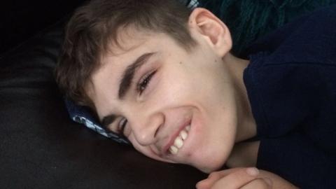 The children living with the world's rarest diseases - BBC News