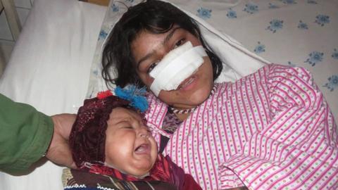 Afghan woman's ears cut off by husband - BBC News
