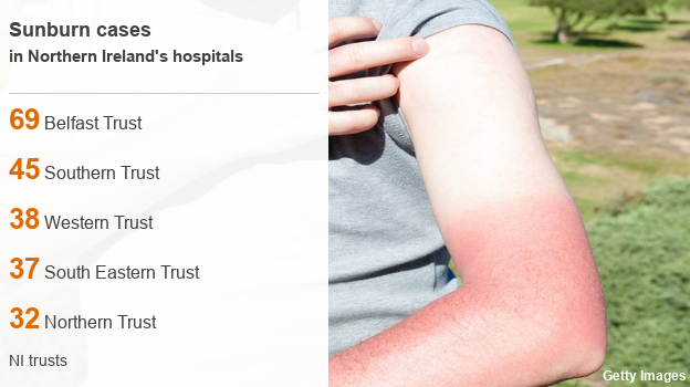 Heatwave sunburn: 220 people treated in NI hospitals - BBC News