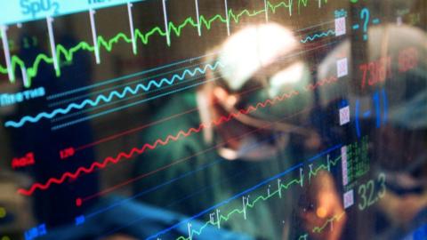 Sepsis: Why can it be so hard to spot? - BBC News