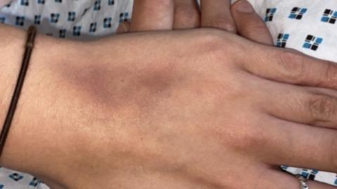 Nottinghamshire Police investigate 15 reports of needle spiking - BBC News