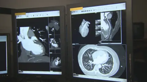Heart patients 'miss out on crucial scans'