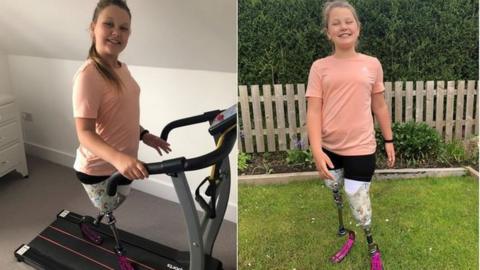 Girl who had legs amputated raises £10k with lockdown walks - BBC News