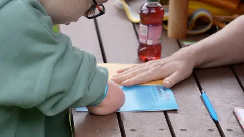 Disability: Support delight for parents of baby with missing limb