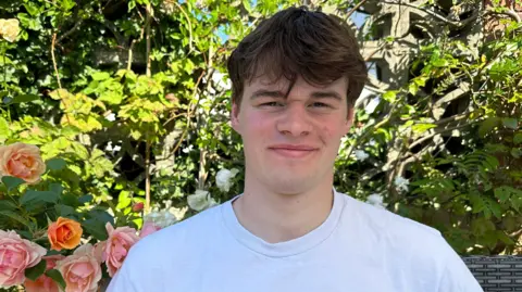 Stroke survivor develops French accent during recovery