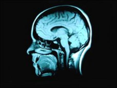 Autistic brains "organised differently" say scientists - BBC News