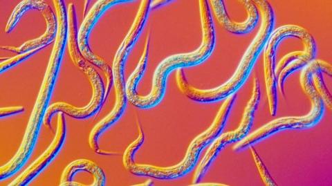 Sound waves used to activate brain cells in a worm - BBC News