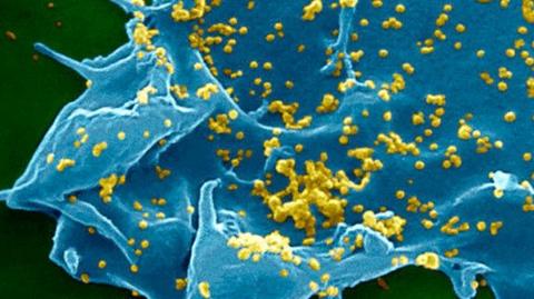 Vaccines for three deadly viruses fast-tracked - BBC News