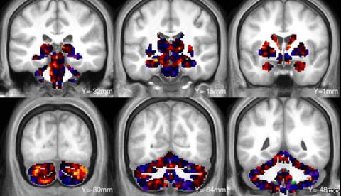 World's most detailed scans will reveal how brain works - BBC News