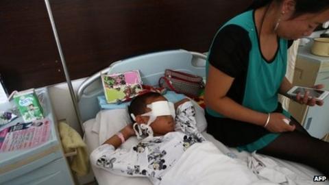 Young Chinese boy's eyes gouged out in attack - BBC News