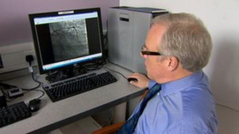 Heart attack technique 'could save lives' - BBC News