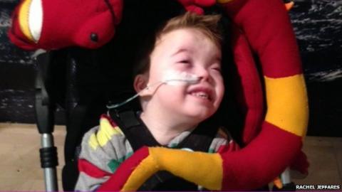 Technology is helping to give genetic disorders a name - BBC News