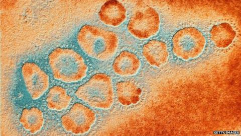 Mers: The mystery virus with no known cure - BBC News