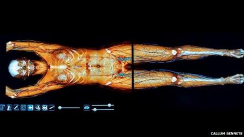 Anatomy students work on life-size virtual cadaver at University of ...