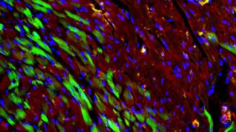 'Biological pacemaker' tested in lab - BBC News