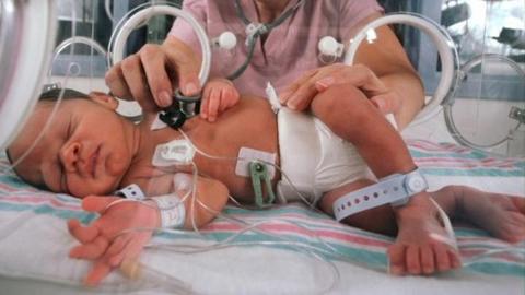 Warning over plastics used in treating premature babies - BBC News