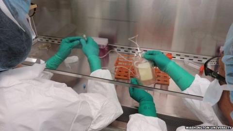 Personal cancer vaccine research 'exciting' say experts - BBC News