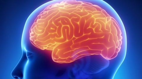 Frontal brain wrinkle linked to hallucinations - BBC News