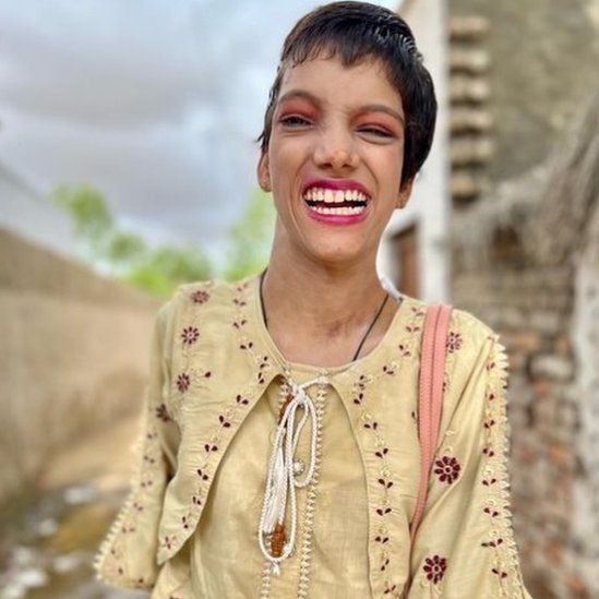 13 سالہ پاکستانی افشین جنھیں انڈین ڈاکٹر نے کامیاب آپریشن کے بعد نئی ...