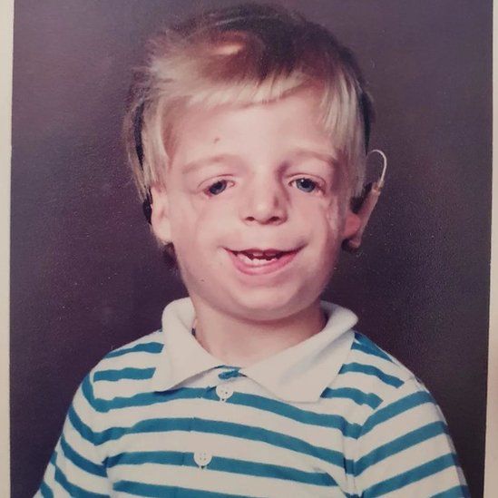 Jono Lancaster : "Avant, je détestais mon visage, mais maintenant j'en ...