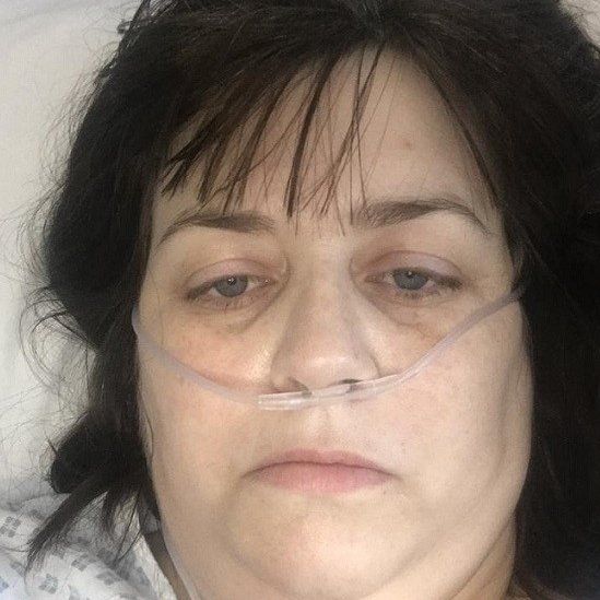 Payout for Ashington woman who got cancer after wrong smear result ...