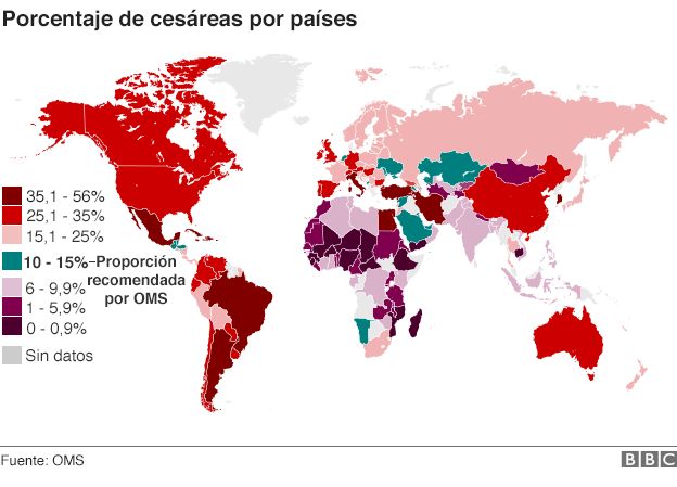 El mapa de los países donde se practican más y menos cesáreas en el ...
