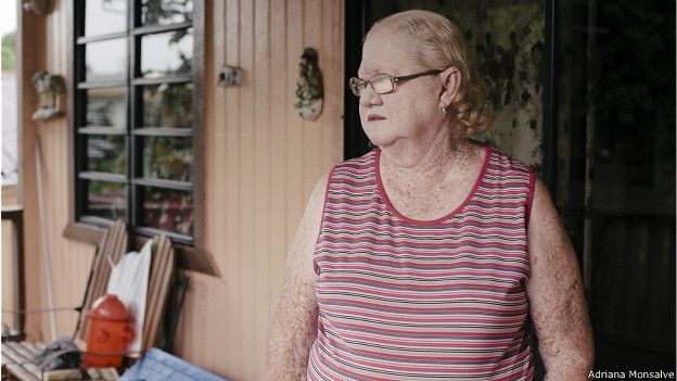 ¿Por qué hay tantos albinos en Puerto Rico? - BBC News Mundo