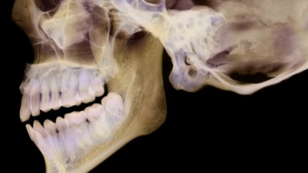 Por que só humanos têm queixo - e para que ele serve? - BBC News Brasil