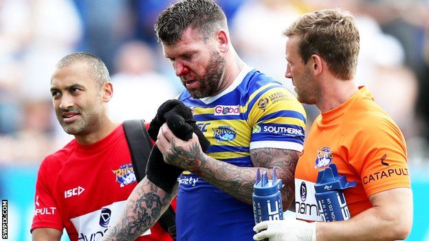 Brett Delaney: Eye injury forces ex-Leeds Rhinos back-rower to retire ...