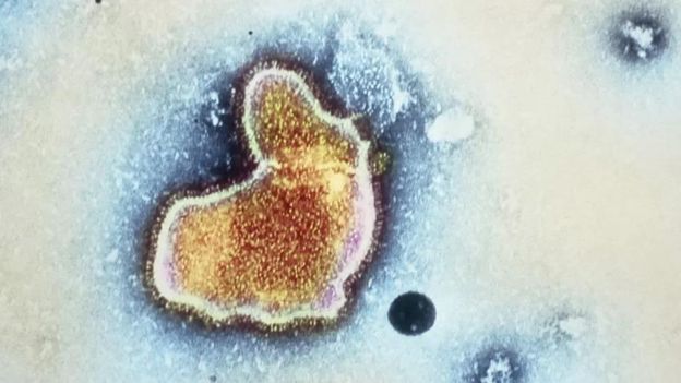 VSR: Como é 1ª vacina do mundo contra vírus sincicial respiratório aprovada nos EUA - BBC News ...