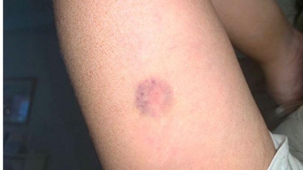 No evidence of spiking by injection, say police - BBC News