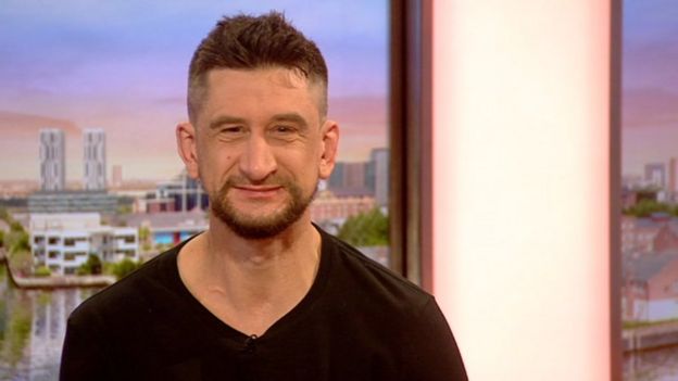 Swindon scaffolder's hand transplants 'changed his life' - BBC News