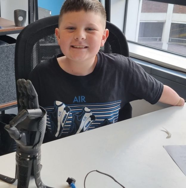 Bude boy to get bionic arm after fundraising campaign - BBC News
