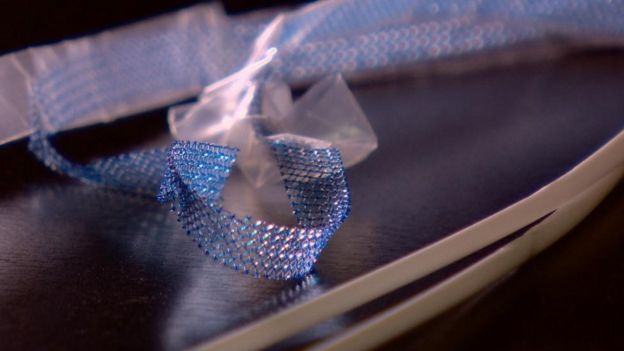 Mesh implants treatment brings unnecessary risks says study - BBC News
