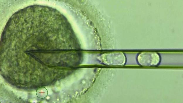 Three-person babies IVF technique ‘safe’ - BBC News