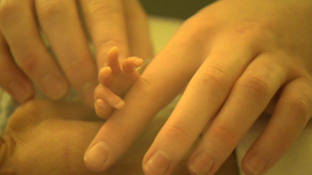 Baby born four months early survives surgery at Tooting hospital - BBC News