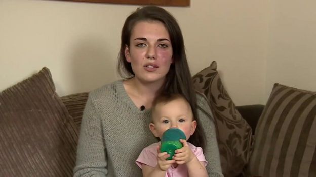 Abortions high 'shows need for contraception access' - BBC News