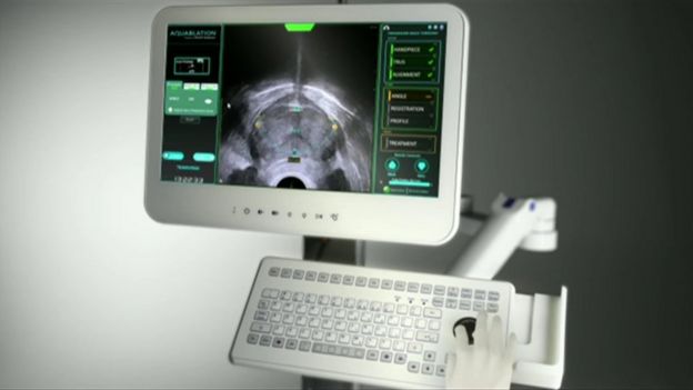 Prostate cancer: Hormone drug gave me years of good health, patient ...