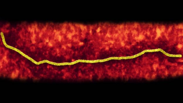 Vaccines for three deadly viruses fast-tracked - BBC News