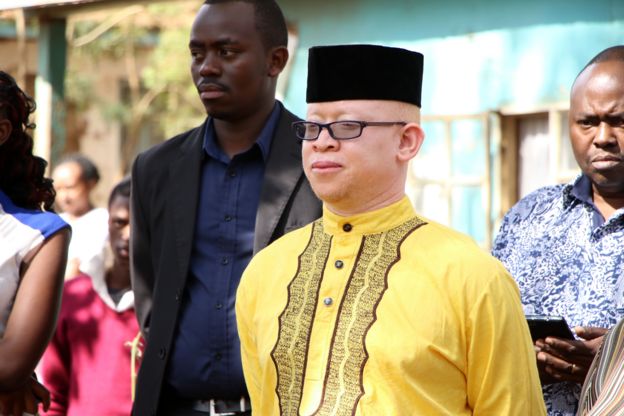 Siku ya Ualbino:Watu wenye ulemavu wa ngozi bado wanapitia changamoto ...