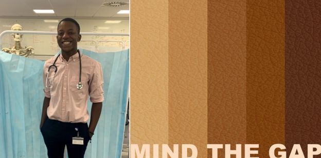 What do medical conditions look like on darker skin? - BBC Newsround